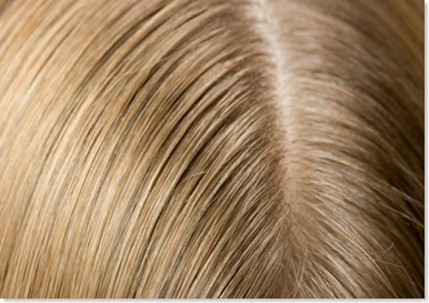 Sensitive Souls with Sensitive Scalps -- and Using Hair Color ...